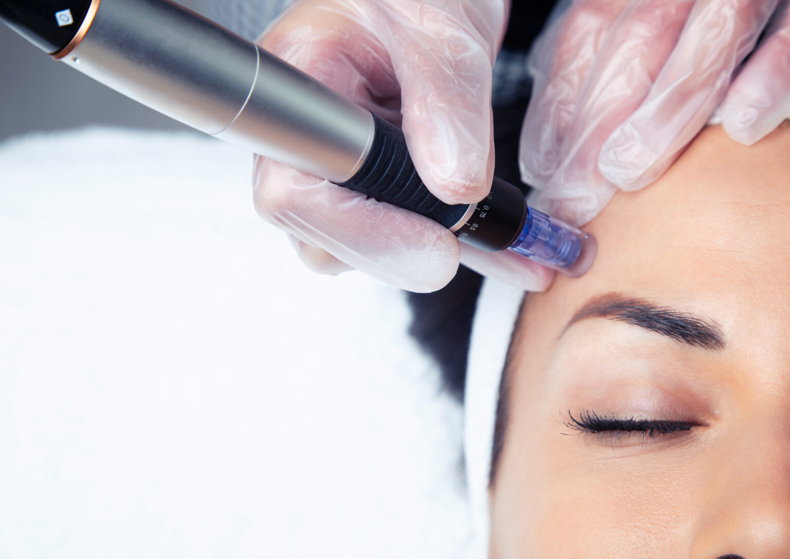 Best Professional Grade Microneedle Devices for at Home Use ...